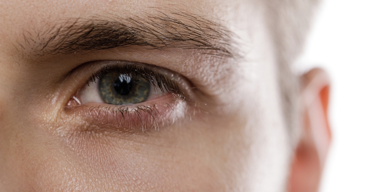 Tips to Stop Watery Eyes | Advice from Your Eye Doctor